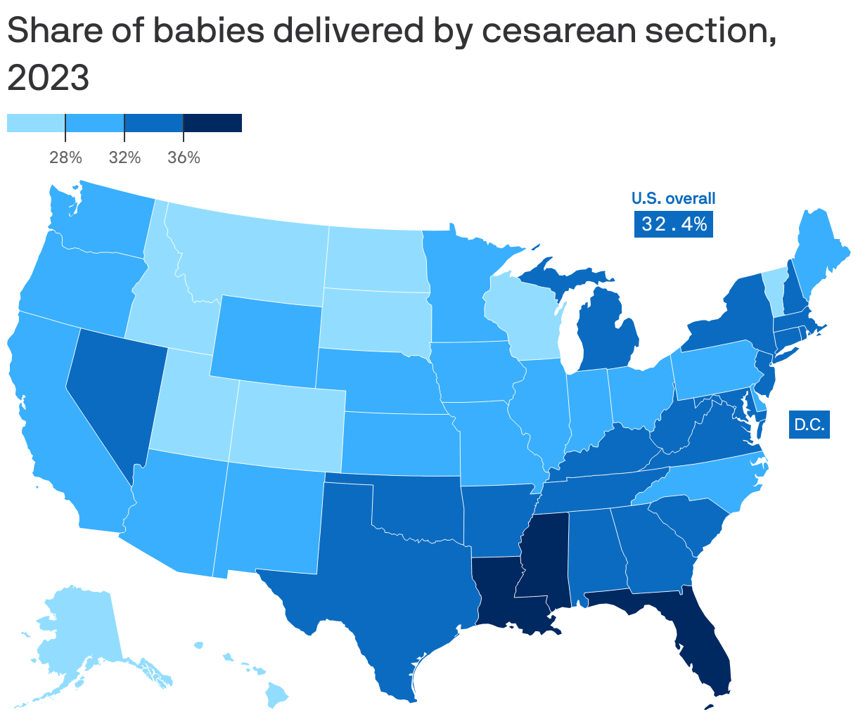 C-sections in the U.S.: Why the rate increased, again